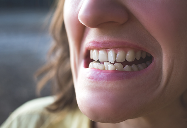 Crooked Teeth Treatment – Fix Crooked Tooth